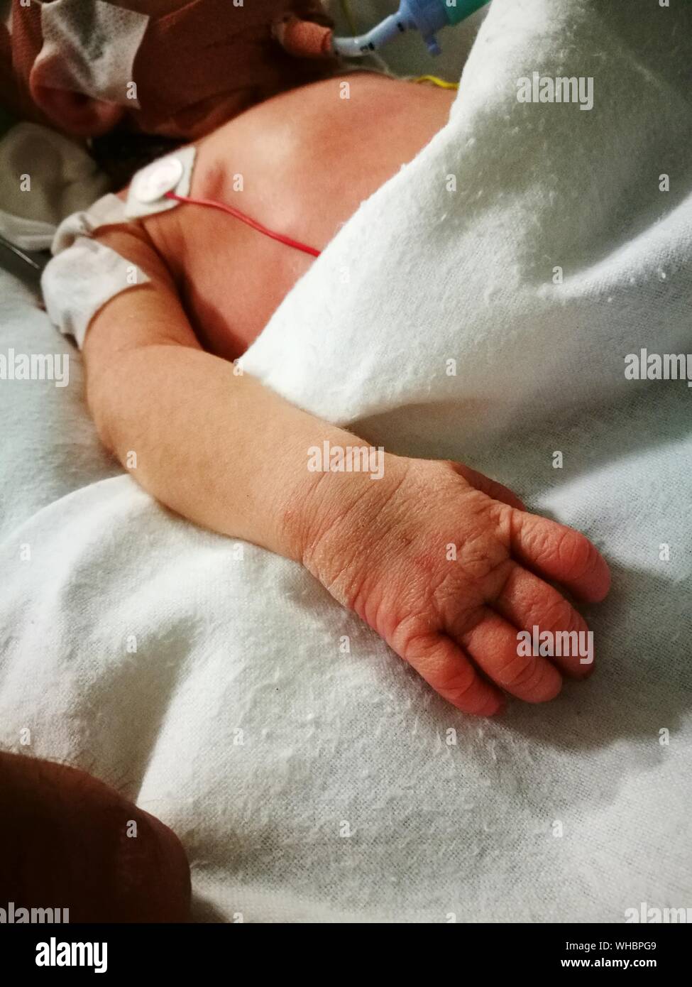 Baby hospital bed hi-res stock photography and images - Alamy