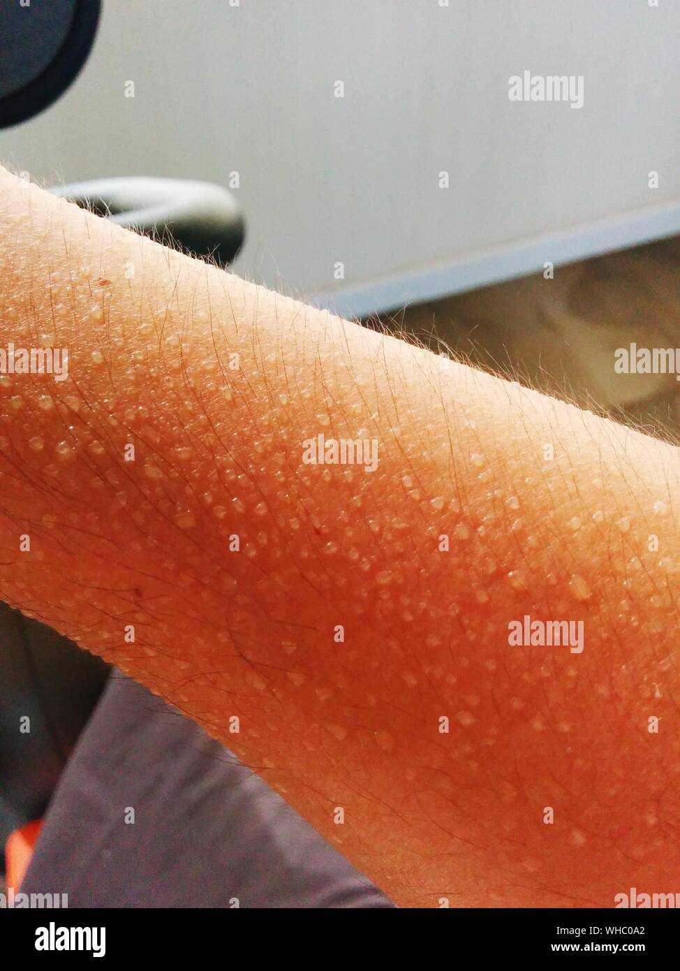 Forearm close hi-res stock photography and images - Alamy