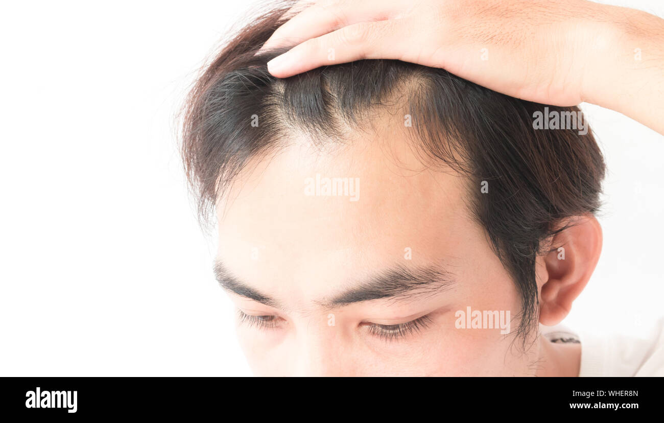 Receding hair hi-res stock photography and images - Alamy