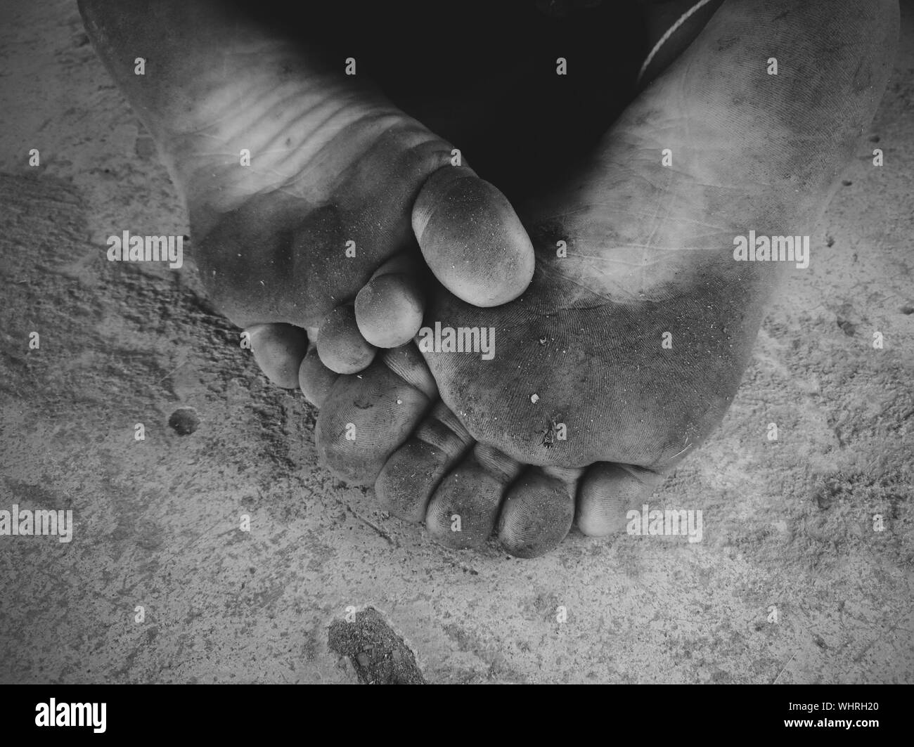 Dirty toe hi-res stock photography and images - Alamy