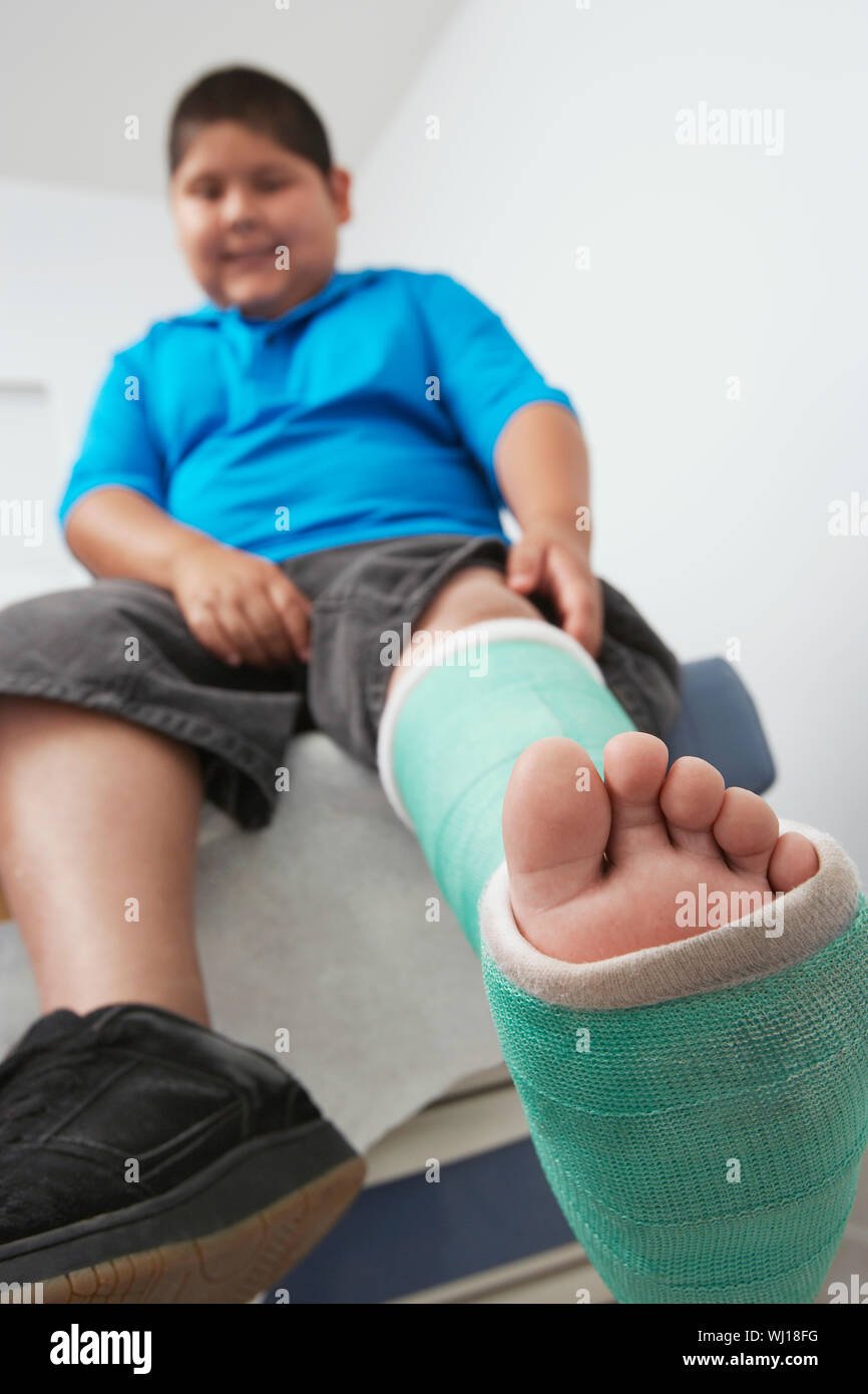 Leg cast boy hi-res stock photography and images - Alamy