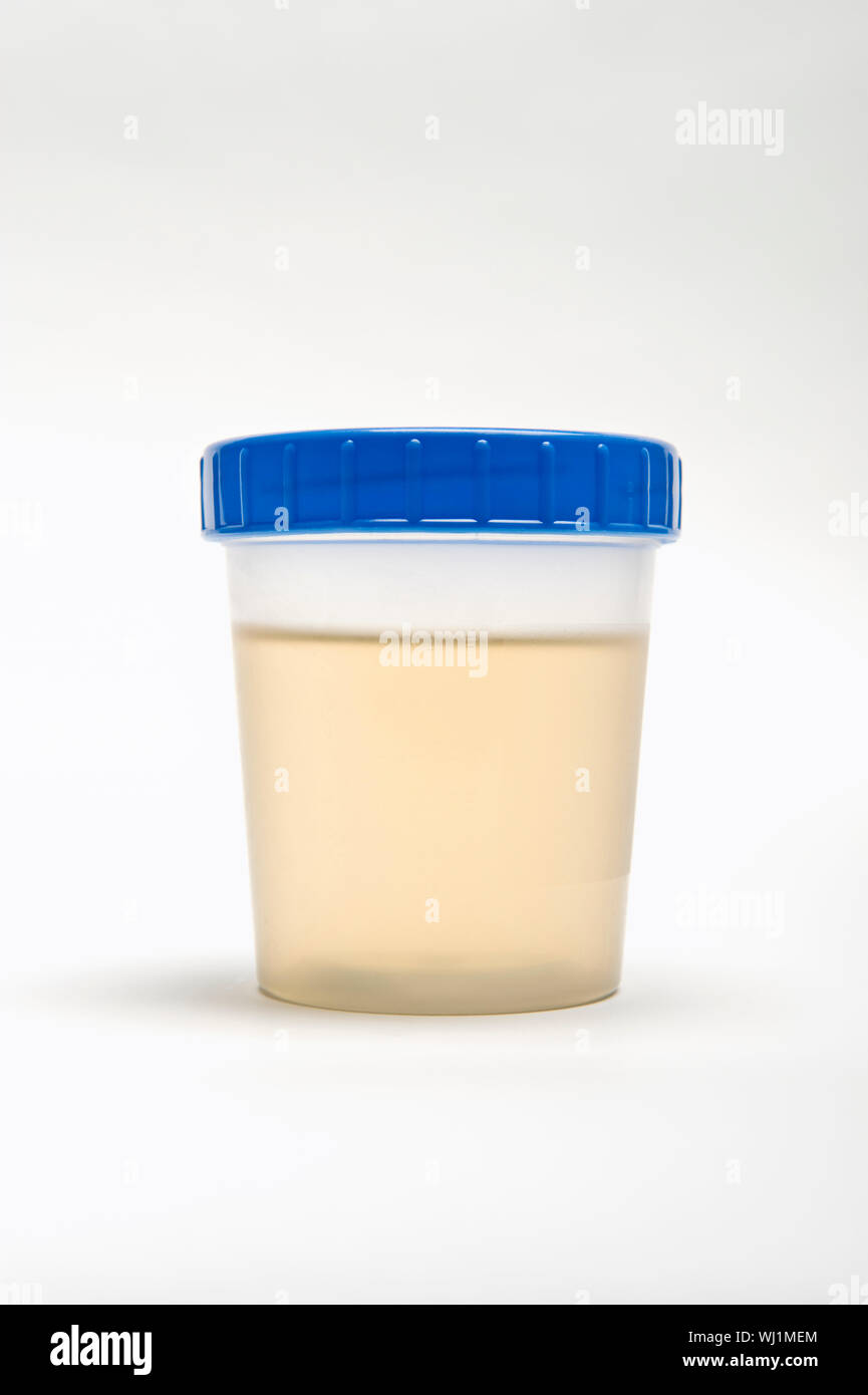 Urine sample in plastic container isolated over white background Stock ...
