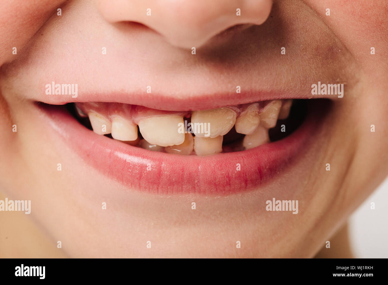Teeth showing smile hi-res stock photography and images - Alamy