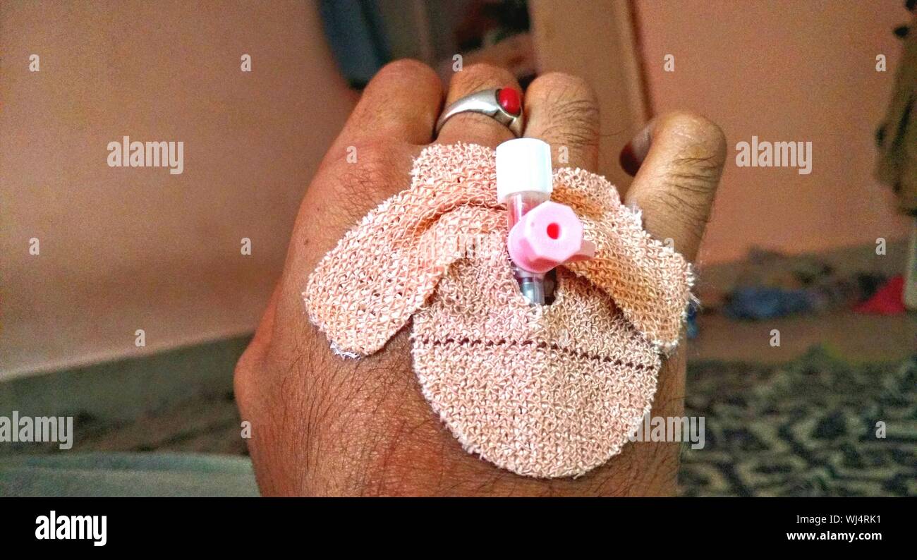 Close-up Of Male Hand With Catheter Stock Photo - Alamy