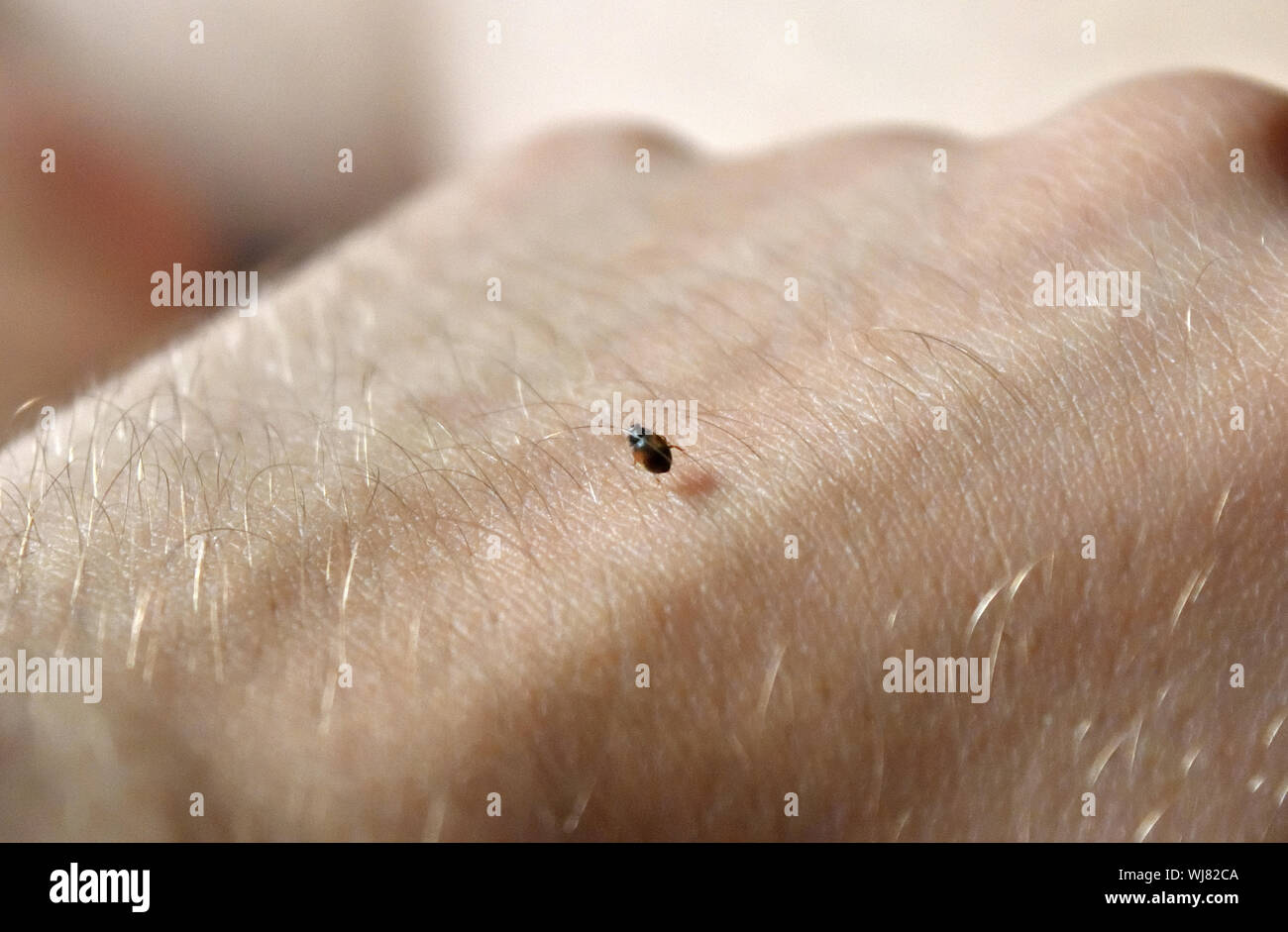 Hand bug hi-res stock photography and images - Alamy