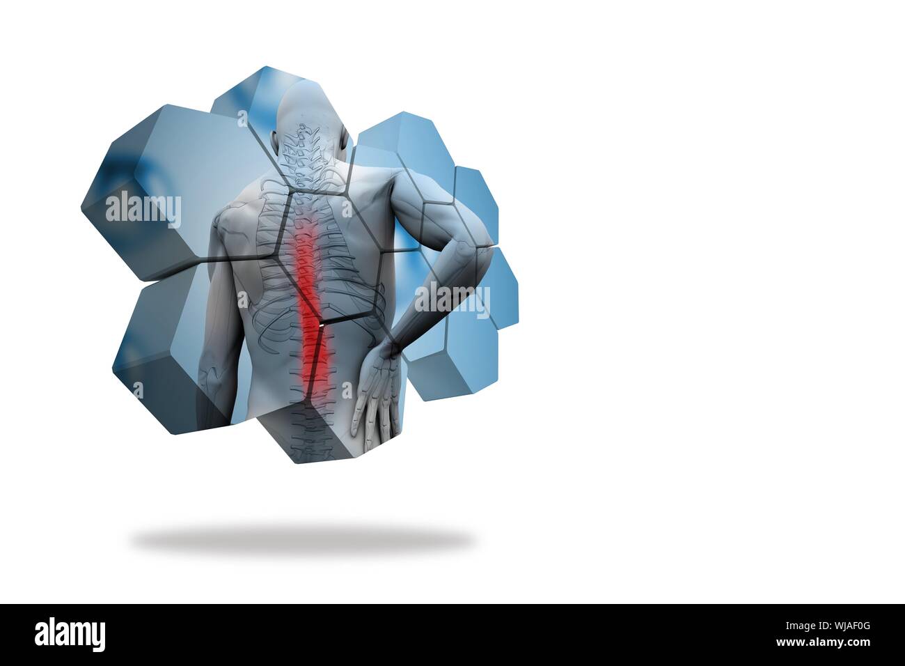 Back injury diagram on abstract screen Stock Photo - Alamy