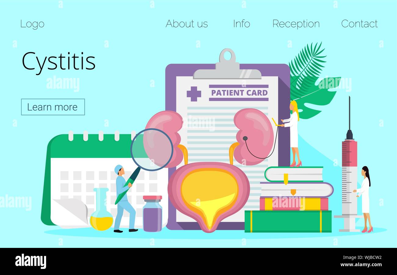 oncept of cystitis, urolithiasis, nephroptosis, renal failure Stock ...
