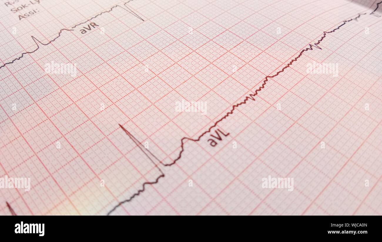 Red graph paper hi-res stock photography and images - Alamy