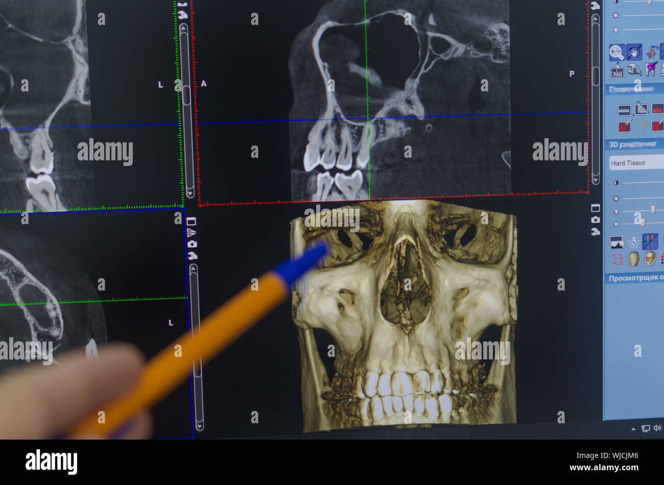 The doctor examines a X-ray examination of the maxillofacial region of ...