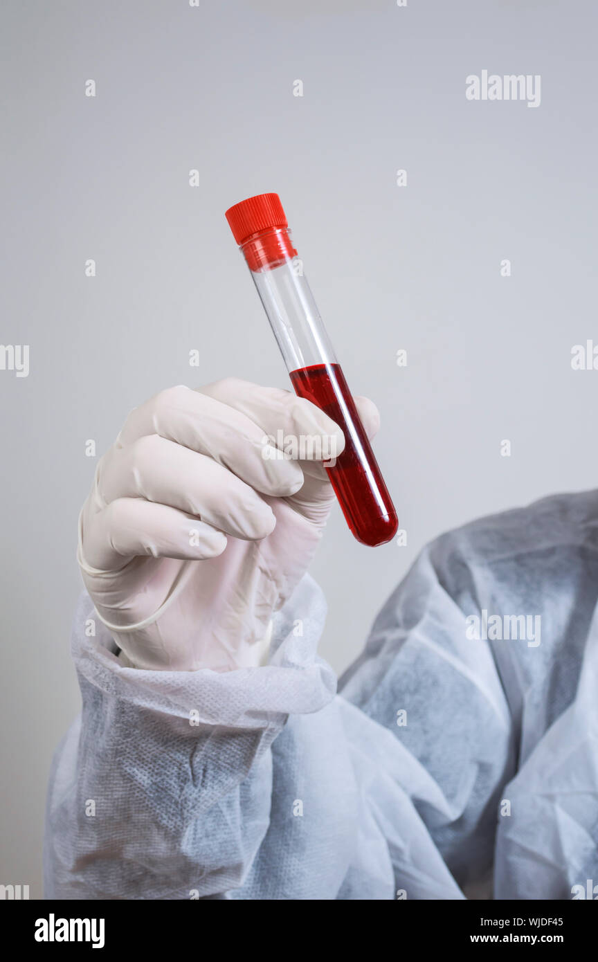 Forensic investigator holding a bottle of blood sample. Science ...