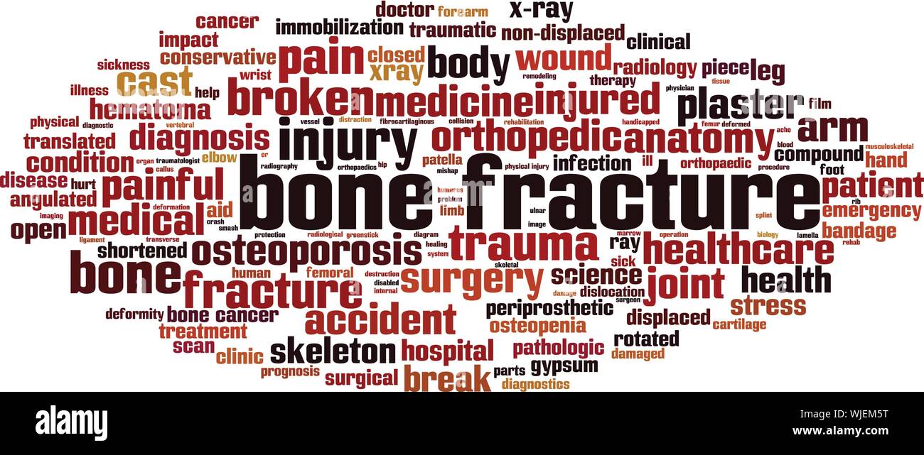 Bone fracture word cloud concept. Collage made of words about bone ...