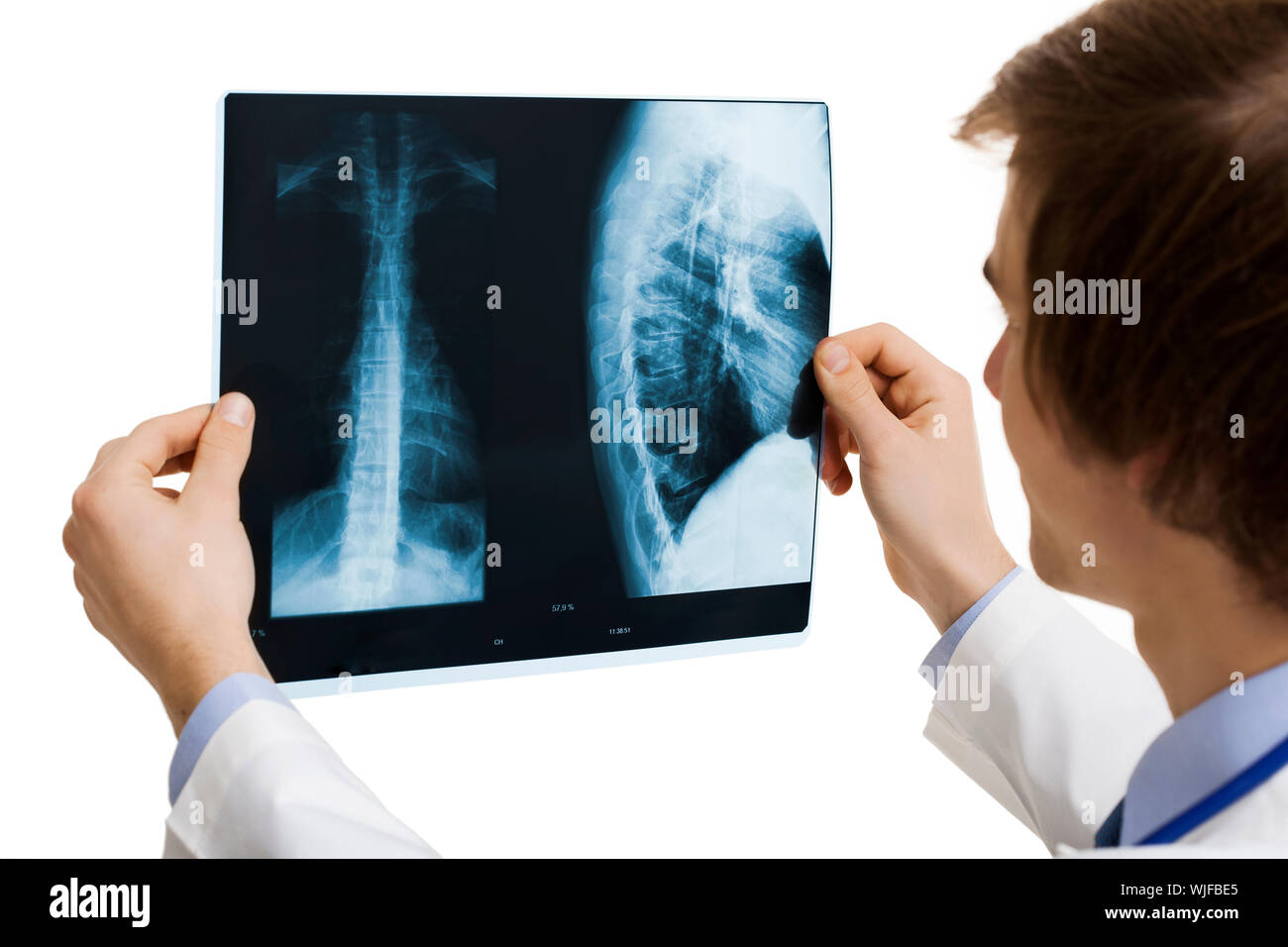 Portrait of a handsome doctor holding a RX, isolated over a white ...