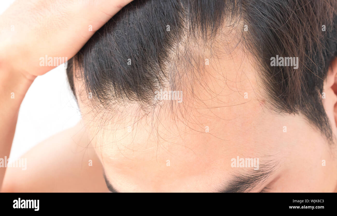 Man hand hair hi-res stock photography and images - Alamy