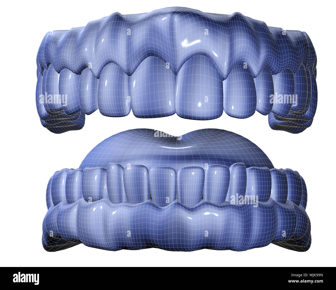 Open denture hi-res stock photography and images - Alamy