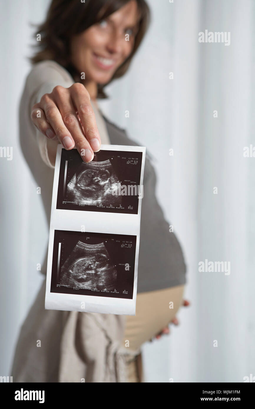 Smiling blurred pregnant woman holding out ultrasound scan photo of ...