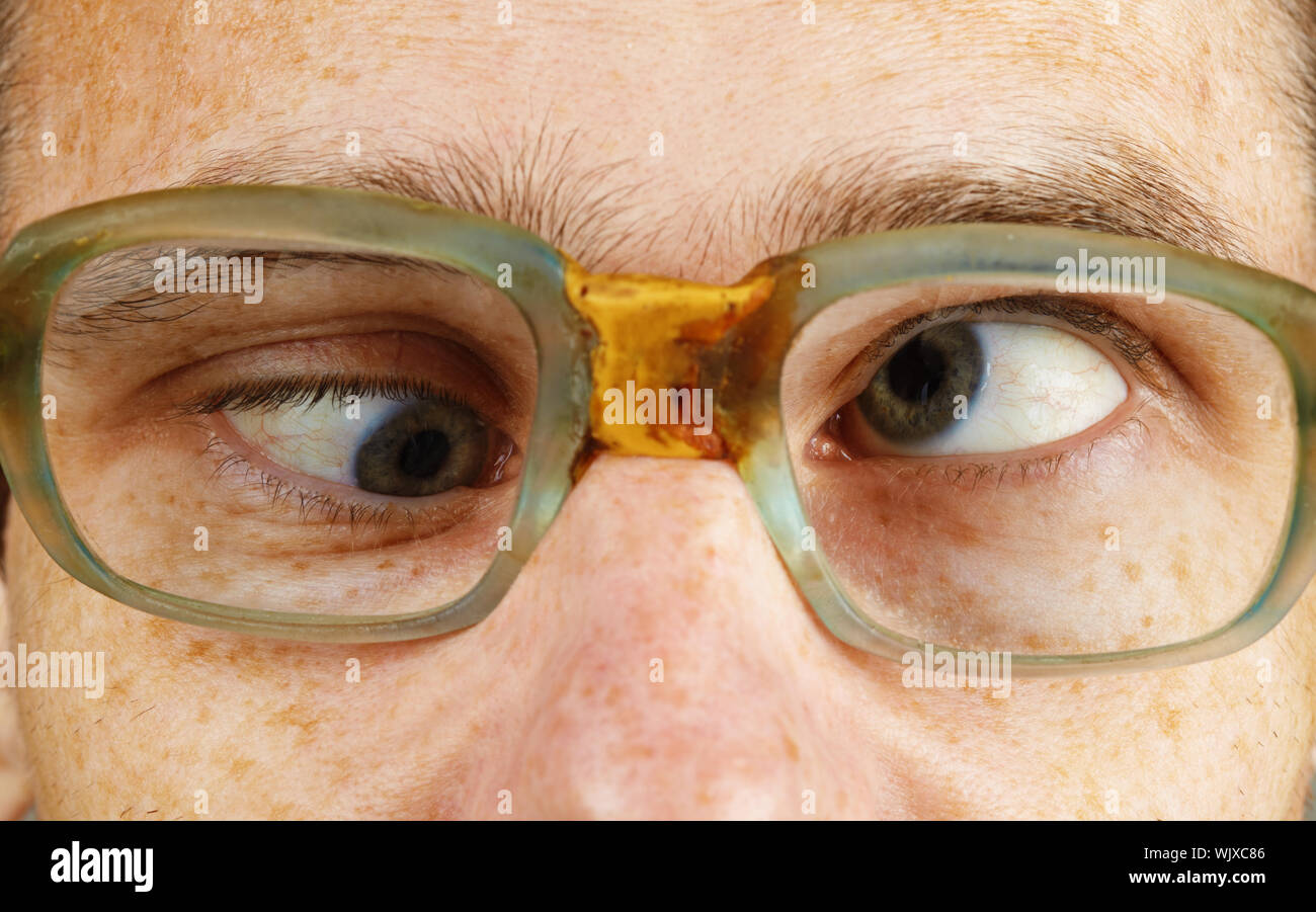 The cross-eyed person in old-fashioned spectacles close up Stock Photo ...