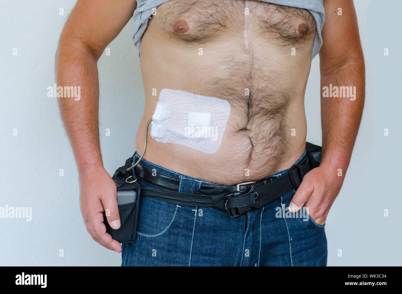 Tube feeding hi-res stock photography and images - Alamy