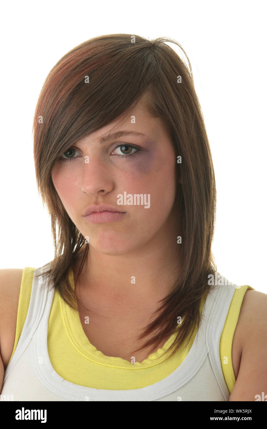 Abused victim isolated on white background Stock Photo - Alamy
