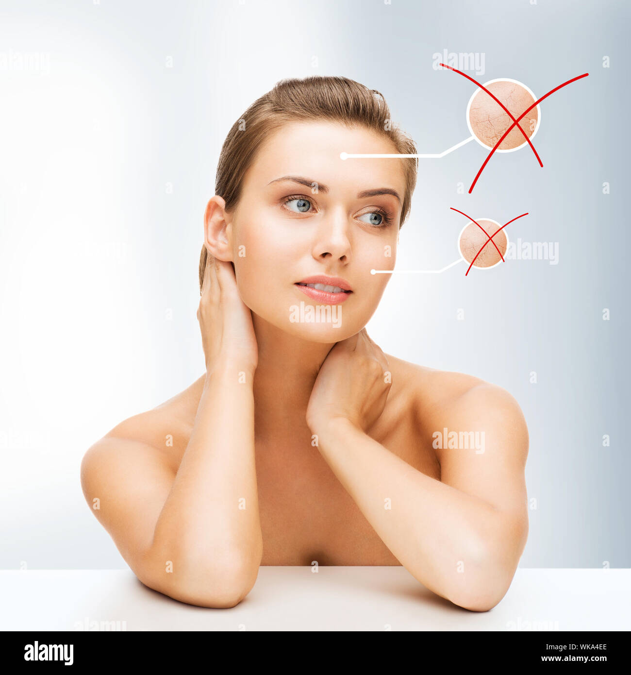 beauty and skin care concept - face of beautiful woman with dry skin ...