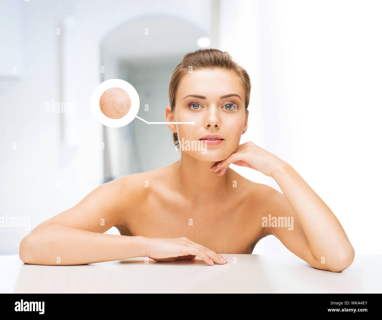 beauty and skin care concept - face of beautiful woman with dry skin ...