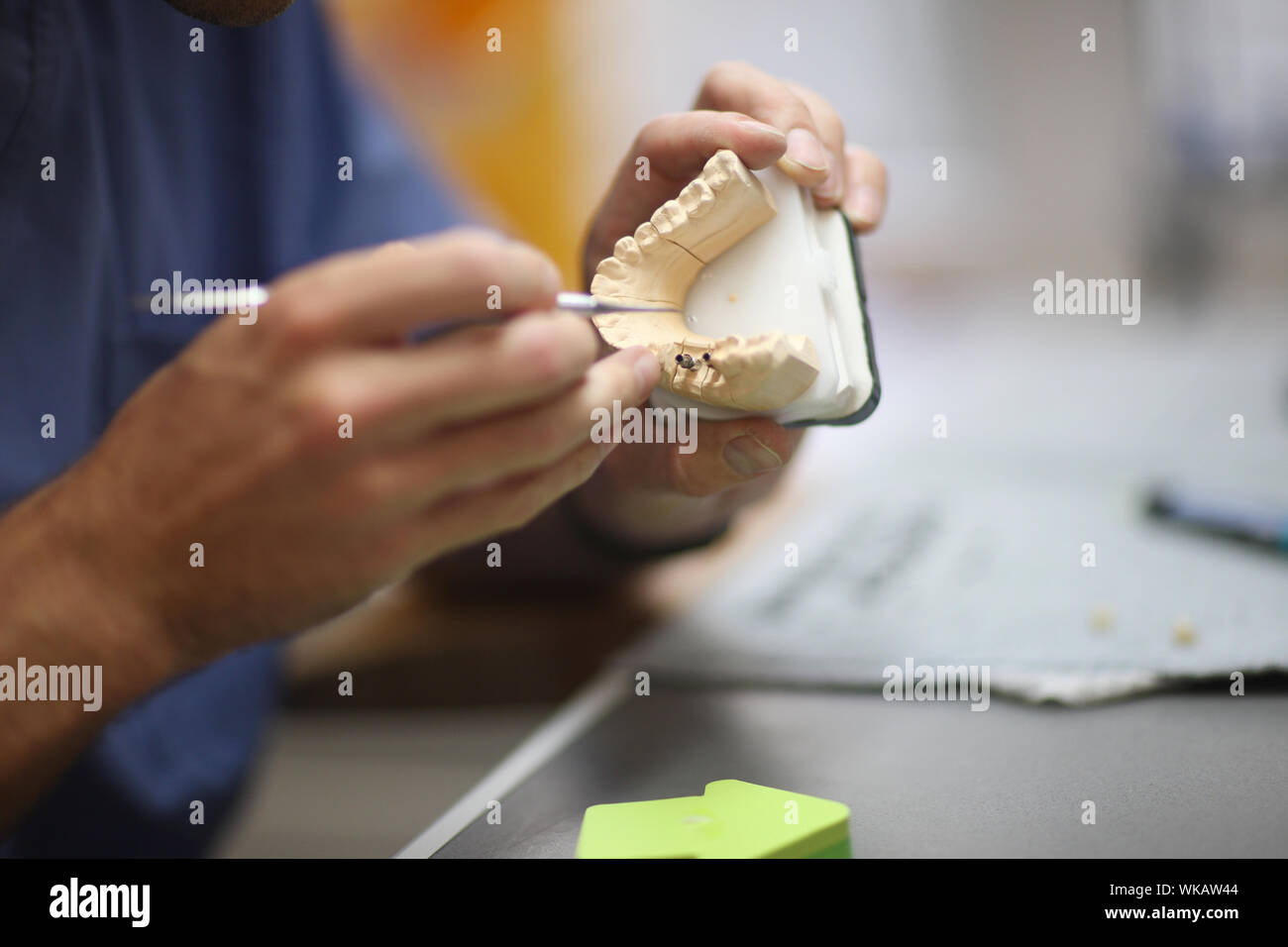 The process of manufacturing dentures in the dental laboratory Stock ...