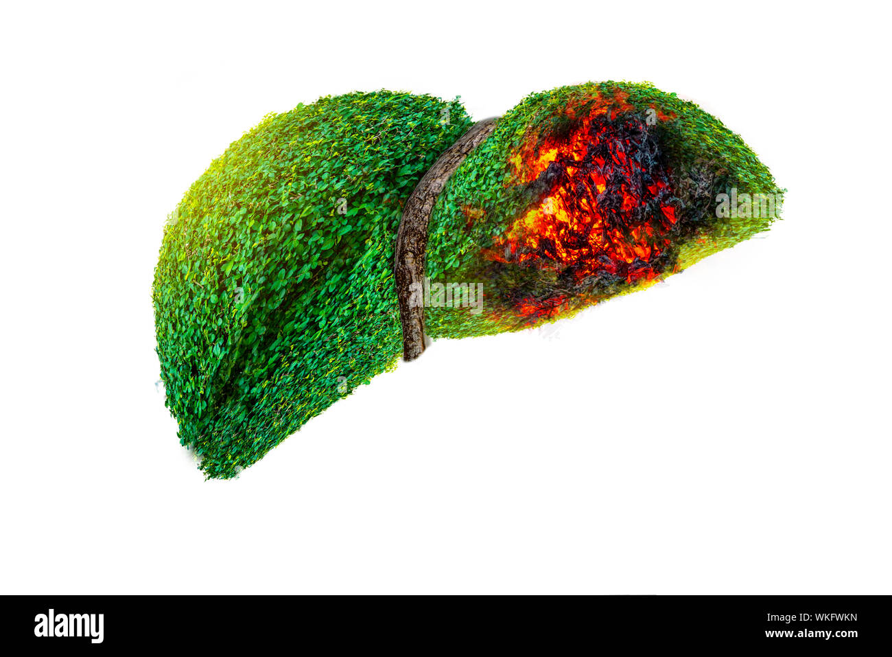 Realistic liver images are human green tree shapes about diseases and ...