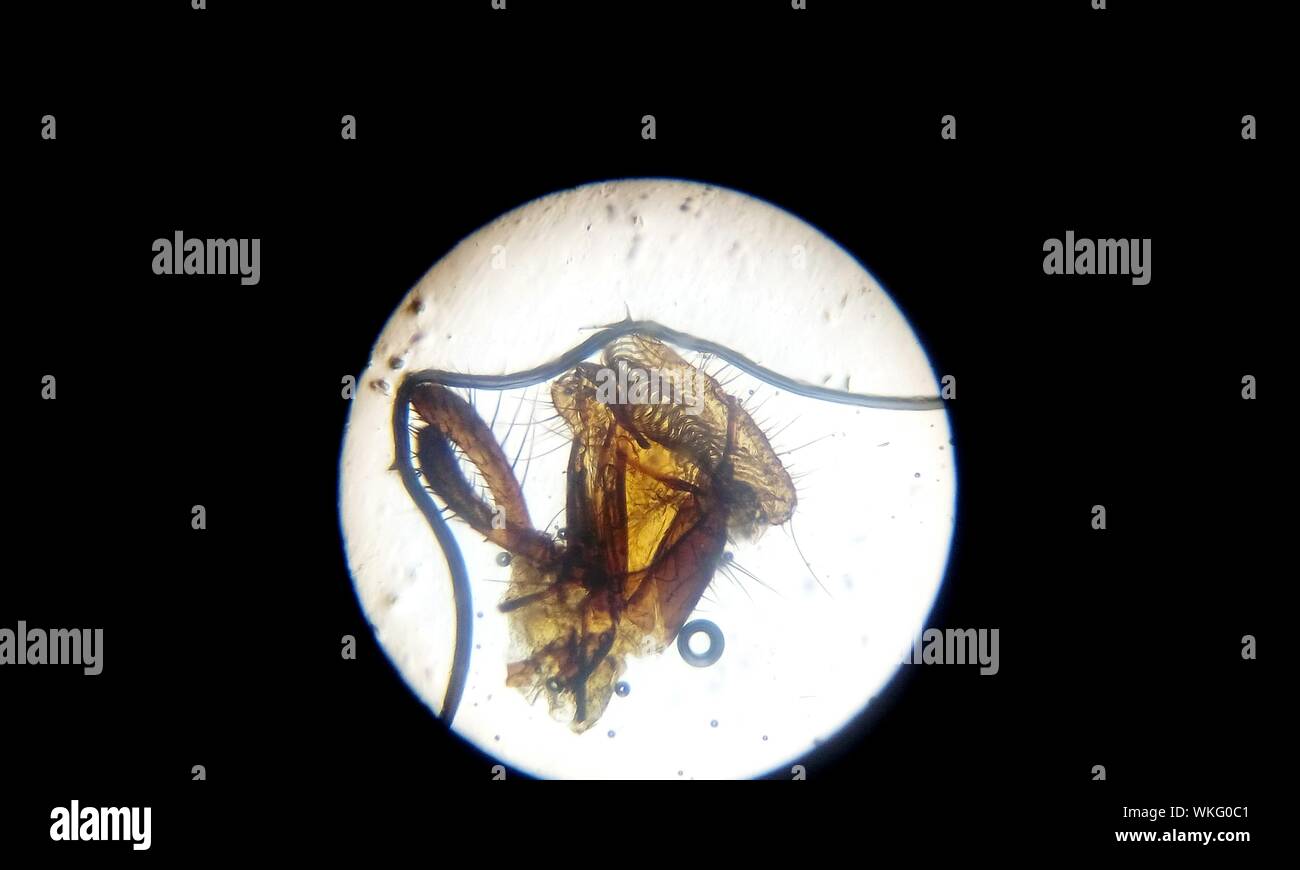 Insect Scanning Electron Microscope High Resolution Stock Photography ...