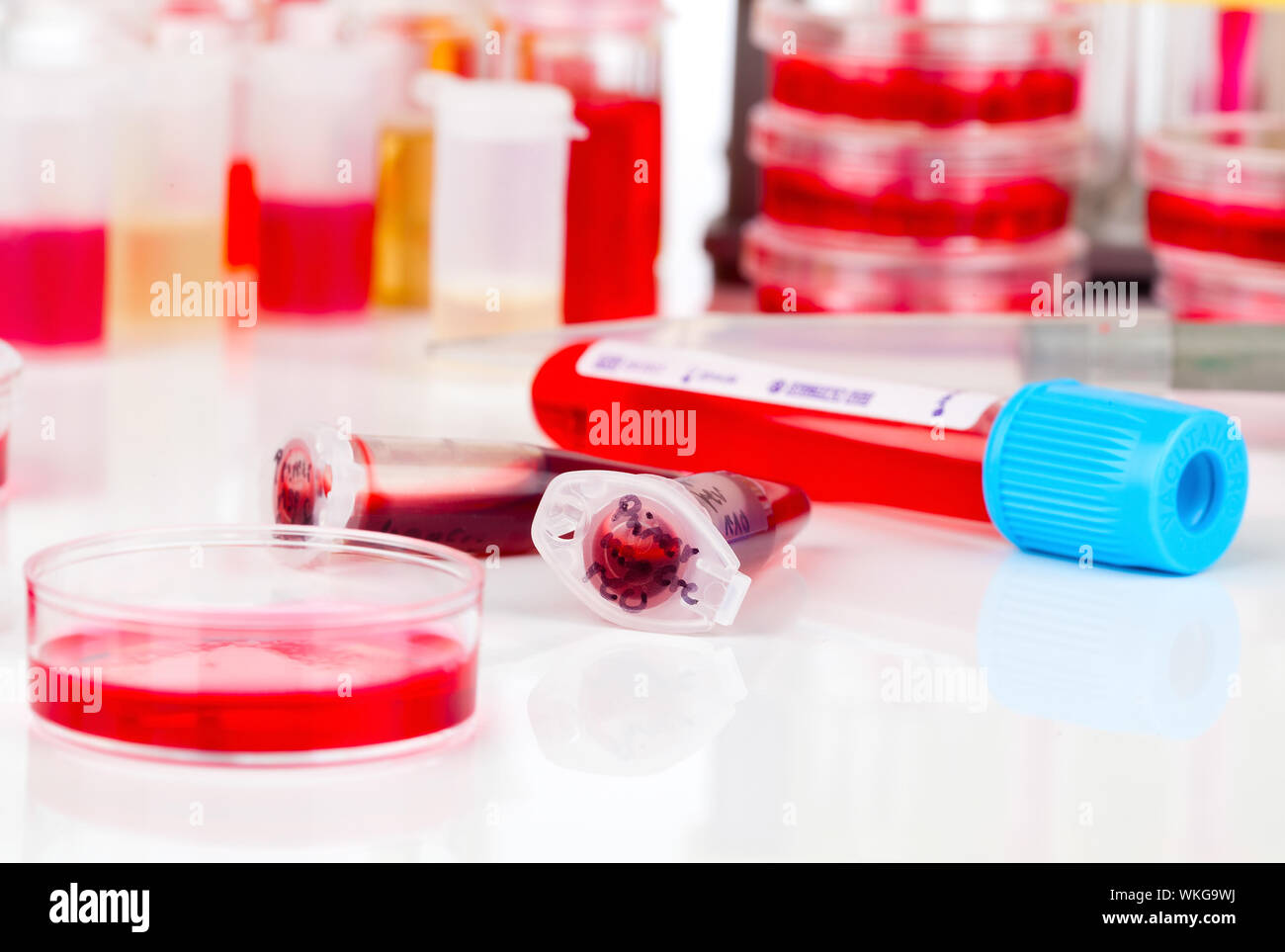 Blood sample in a test tube Stock Photo - Alamy