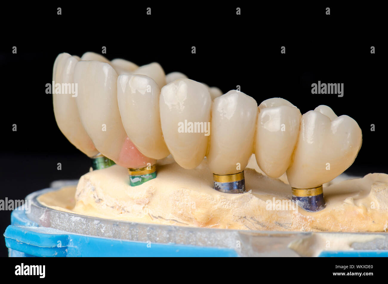 Dentures isolated hi-res stock photography and images - Alamy