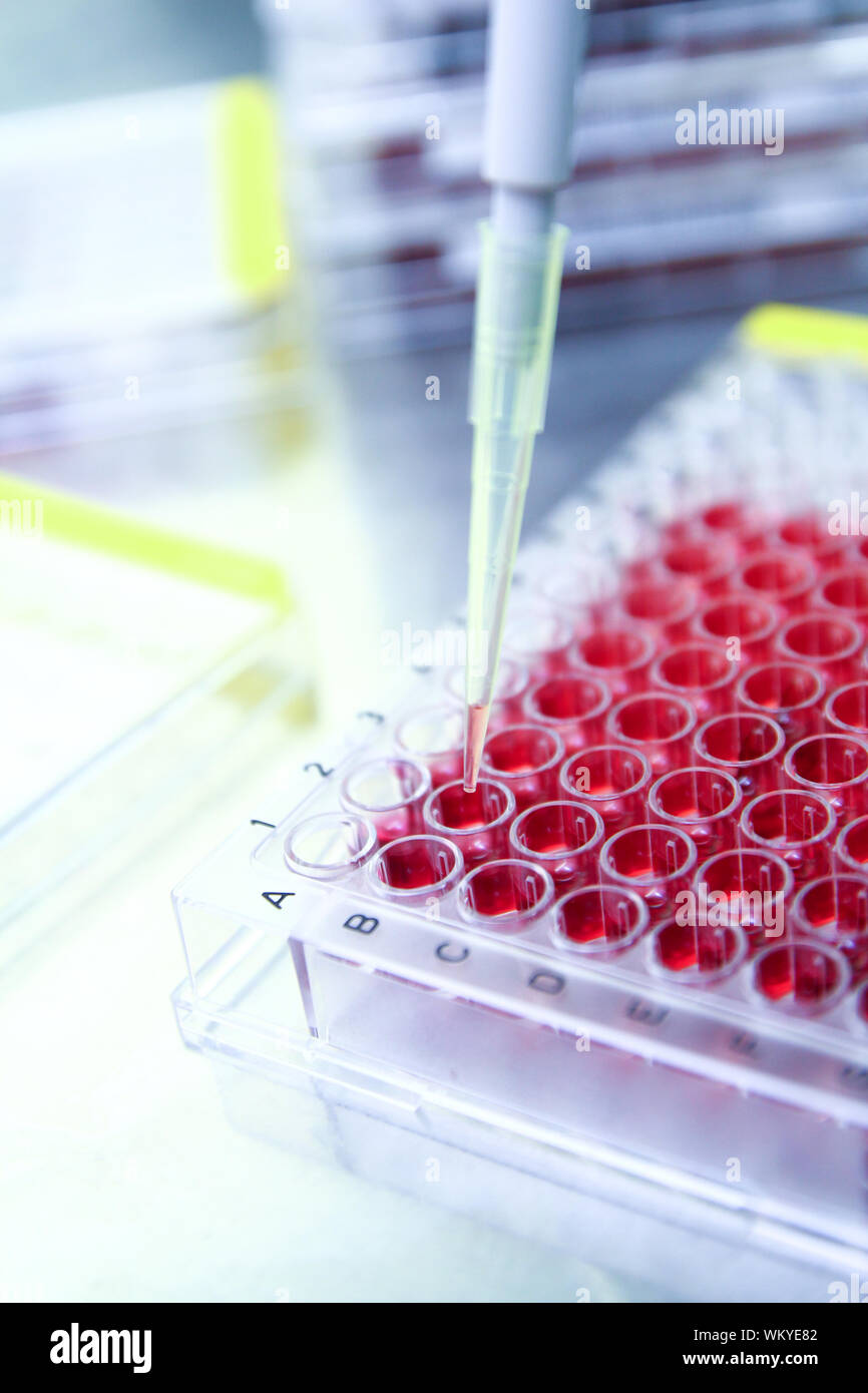 Test tube rack hi-res stock photography and images - Alamy