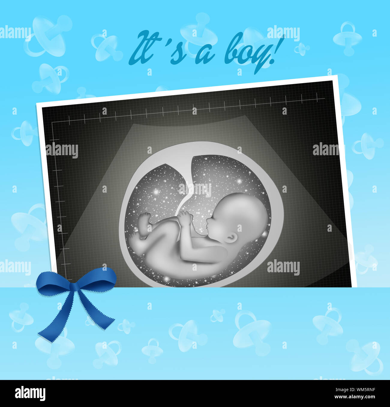 echography for baby Stock Photo - Alamy