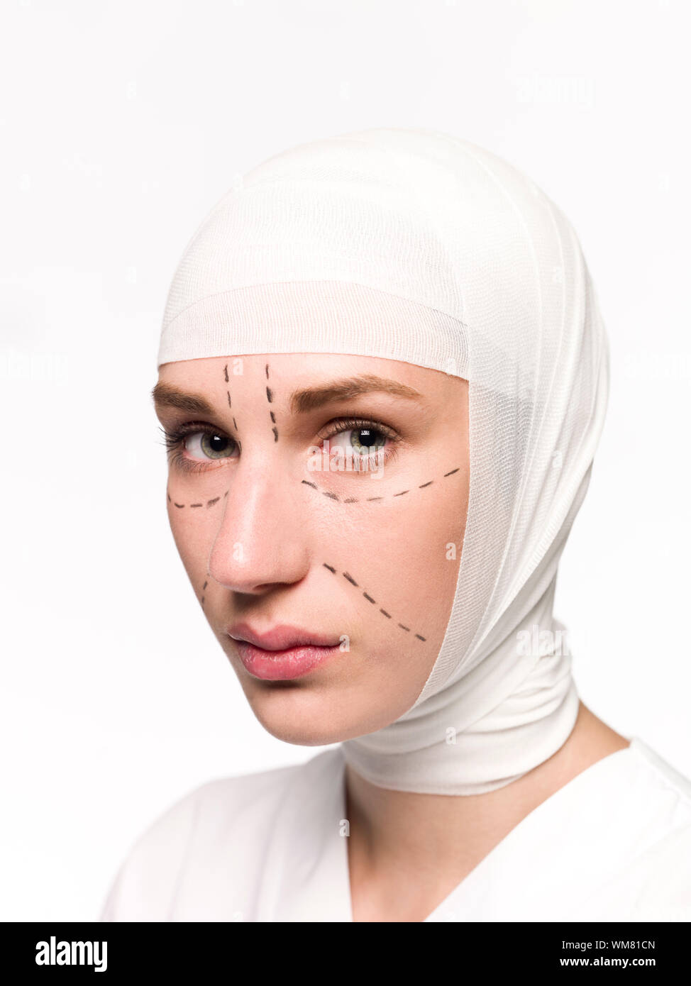 Woman prepared for a plastic surgery Stock Photo - Alamy