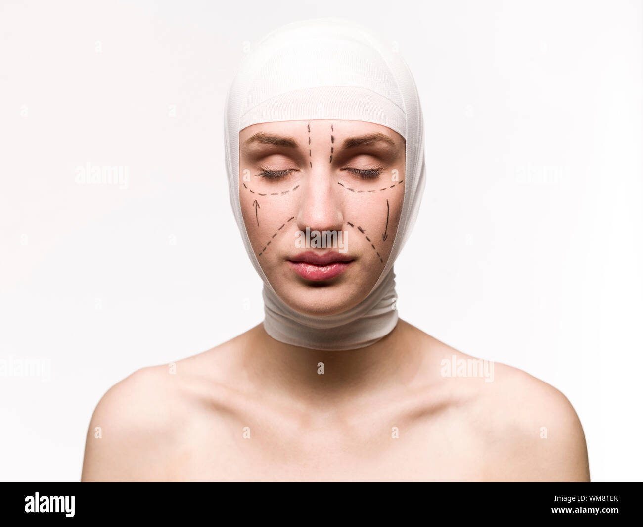 Woman prepared for a plastic surgery Stock Photo - Alamy