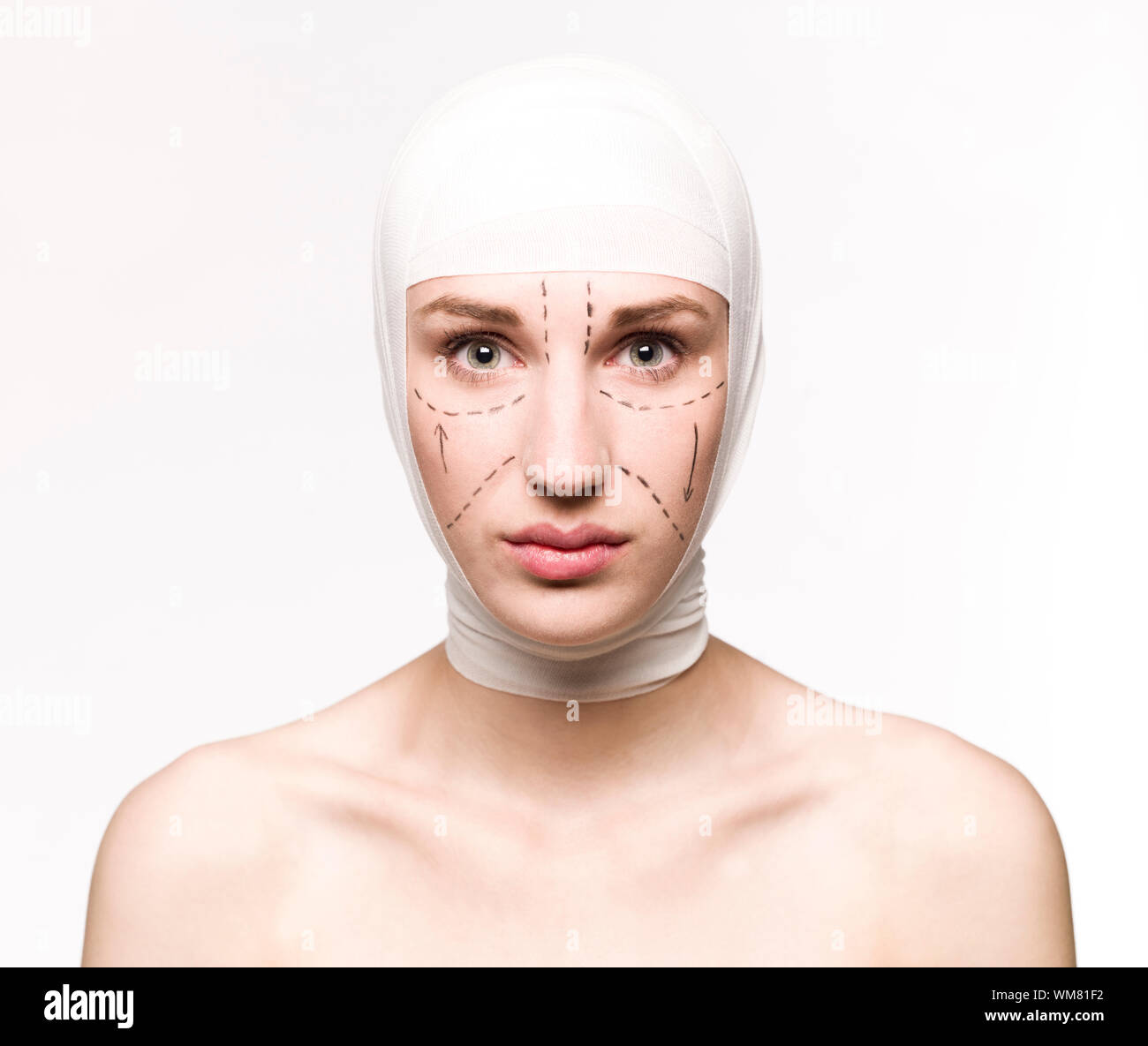 Woman prepared for a plastic surgery Stock Photo - Alamy