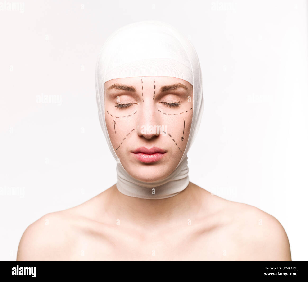 Woman prepared for a plastic surgery Stock Photo - Alamy