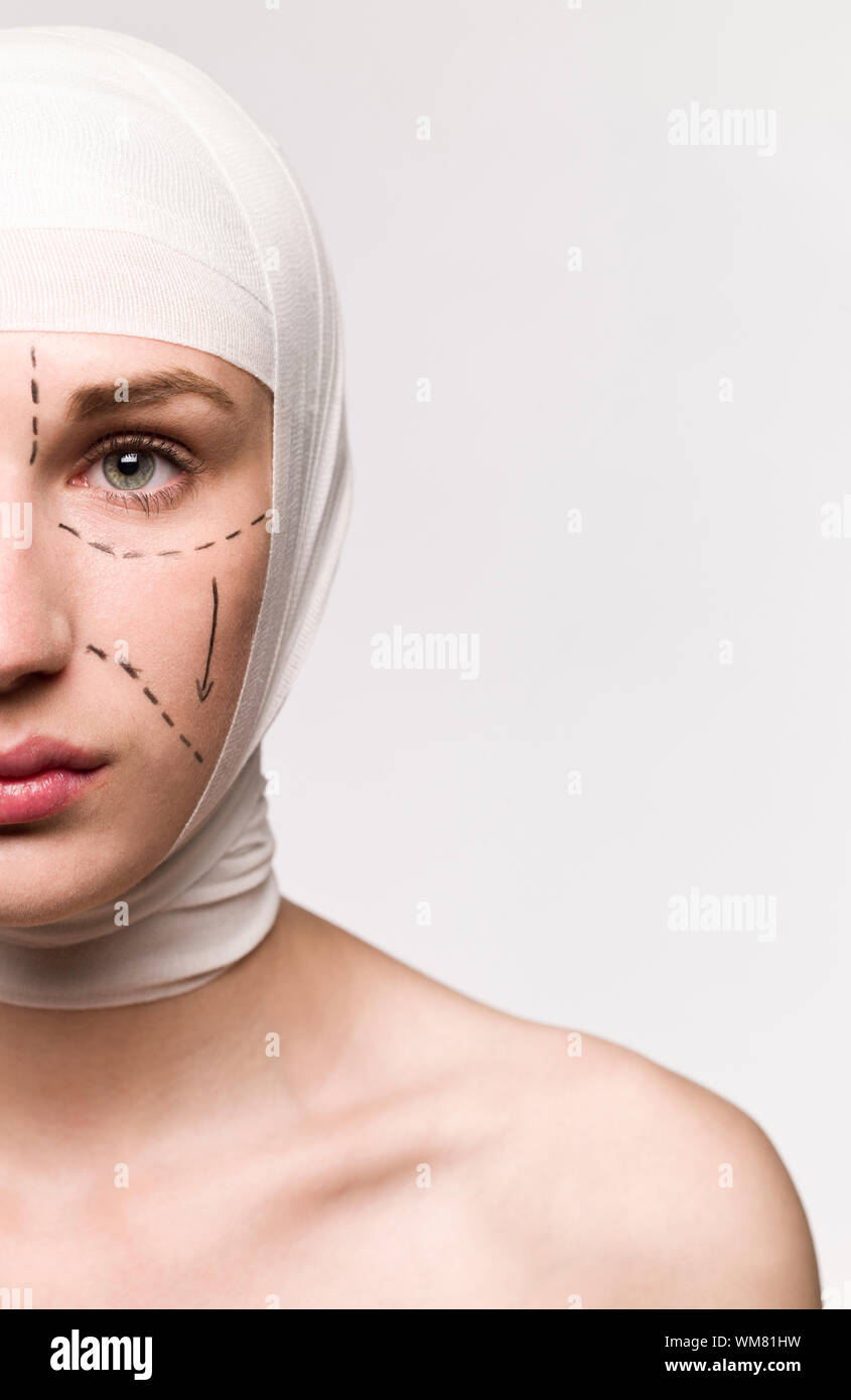 Woman prepared for a plastic surgery Stock Photo - Alamy