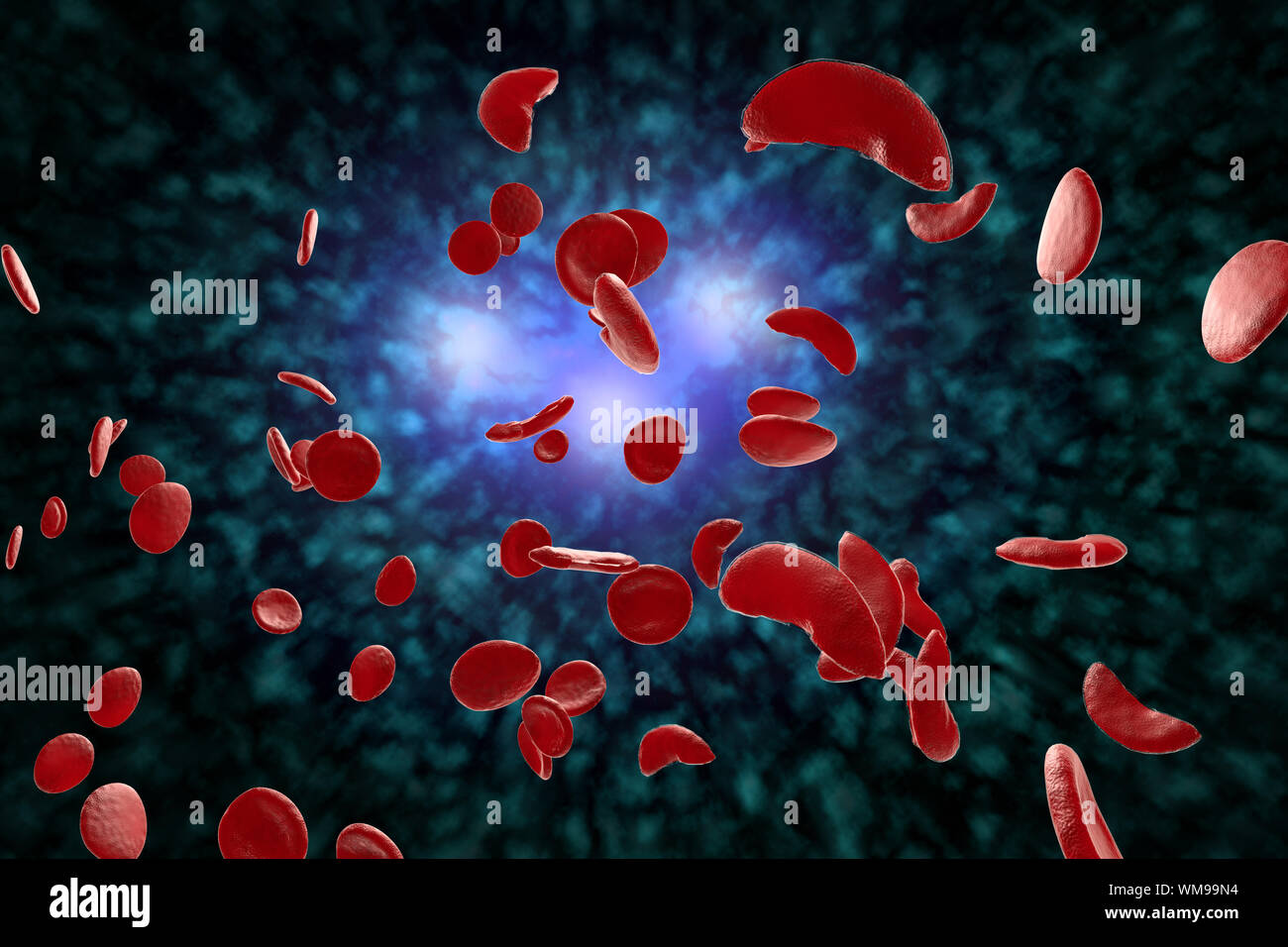 Sickle cell anemia hi-res stock photography and images - Alamy