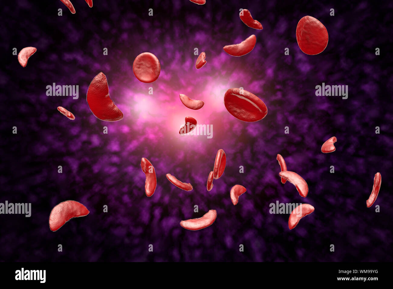 Sickle cell anemia disease (SCD) blood cells 3D illustration Stock ...