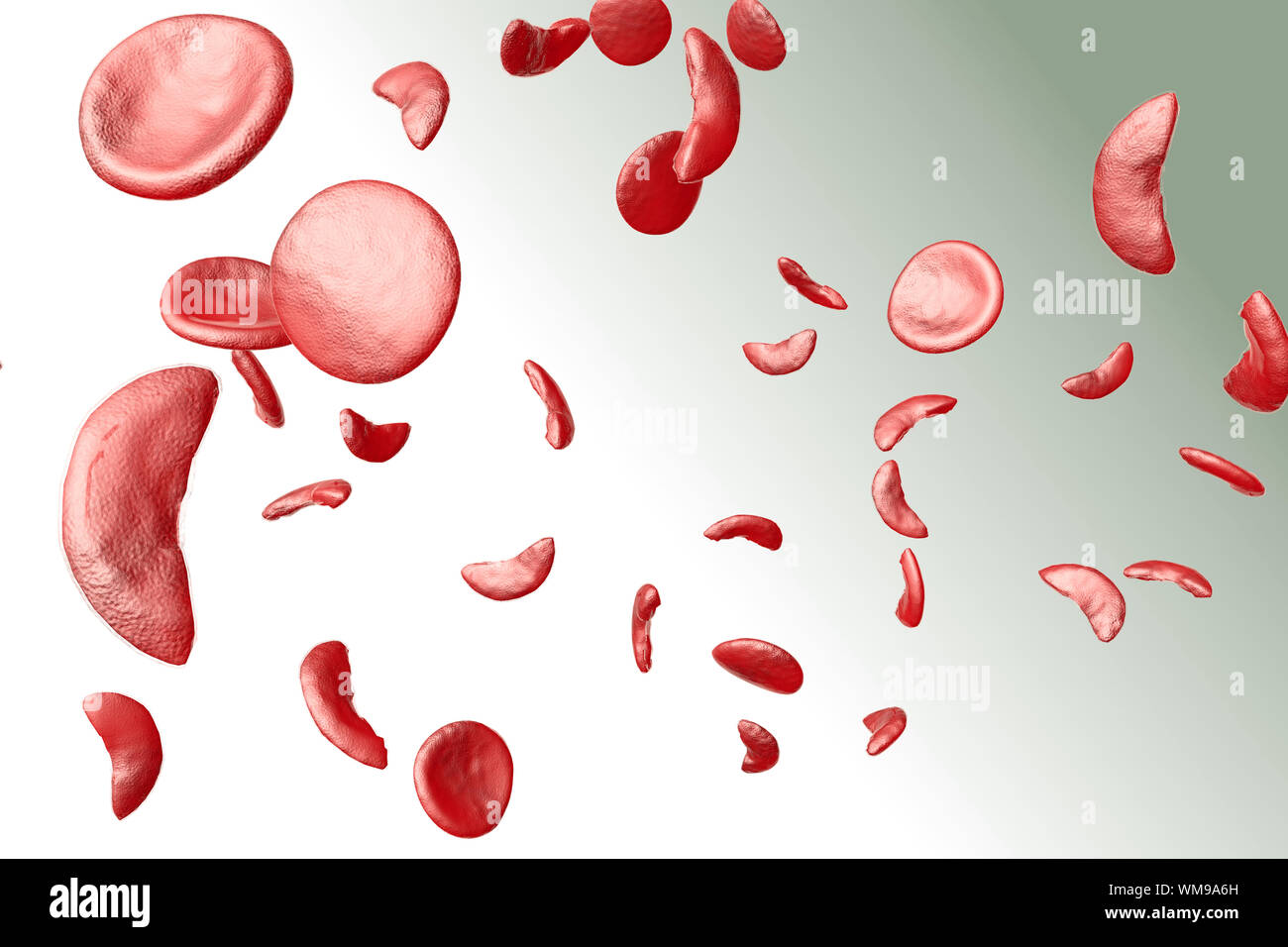 Sickle cell anemia disease (SCD) blood cells 3D illustration Stock ...