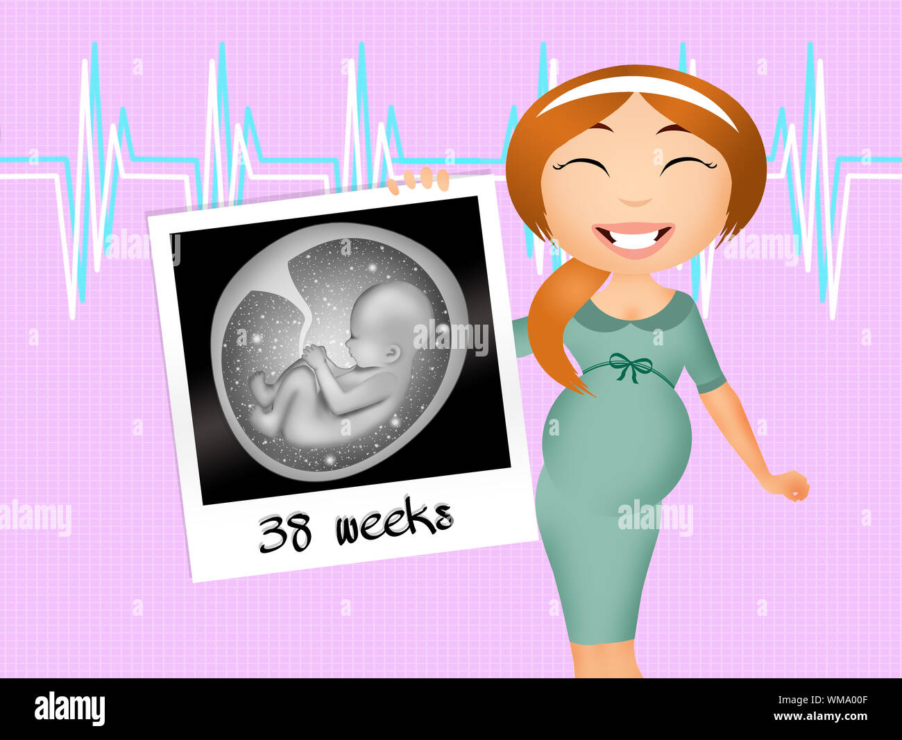 pregnancy to term Stock Photo - Alamy