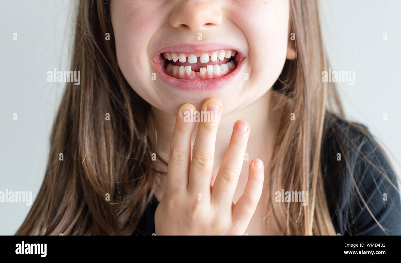 Tooth missing laughing hi-res stock photography and images - Alamy