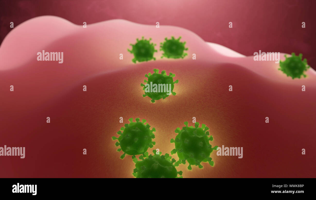 Viral Infections of the Lymphatic Systems. Infection And ...