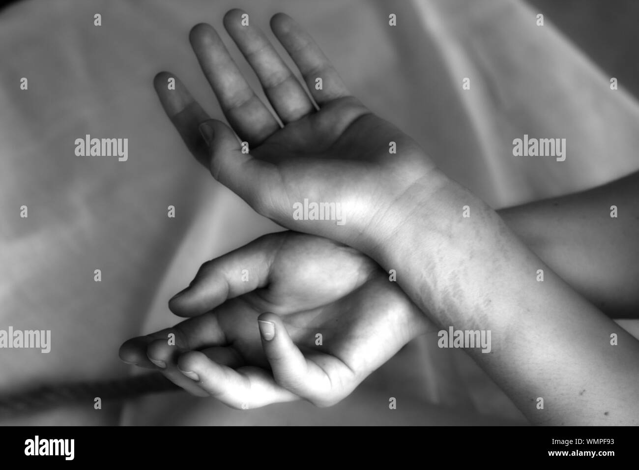 Black marks on body hi-res stock photography and images - Alamy