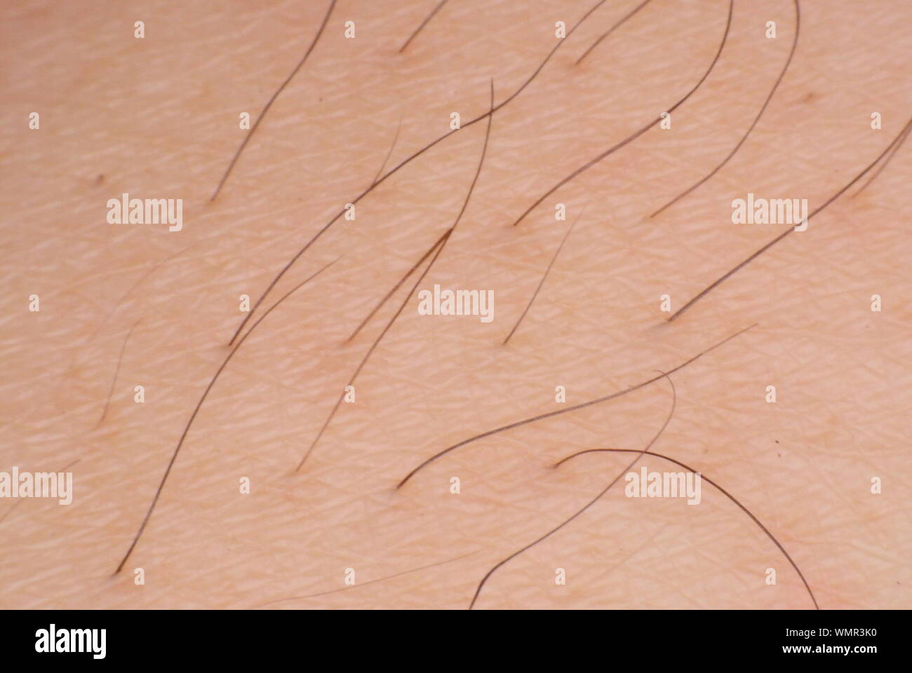 Human skin macro hi-res stock photography and images - Alamy