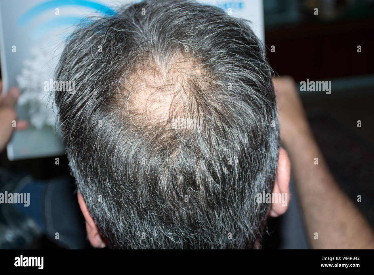 Balding person hi-res stock photography and images - Alamy