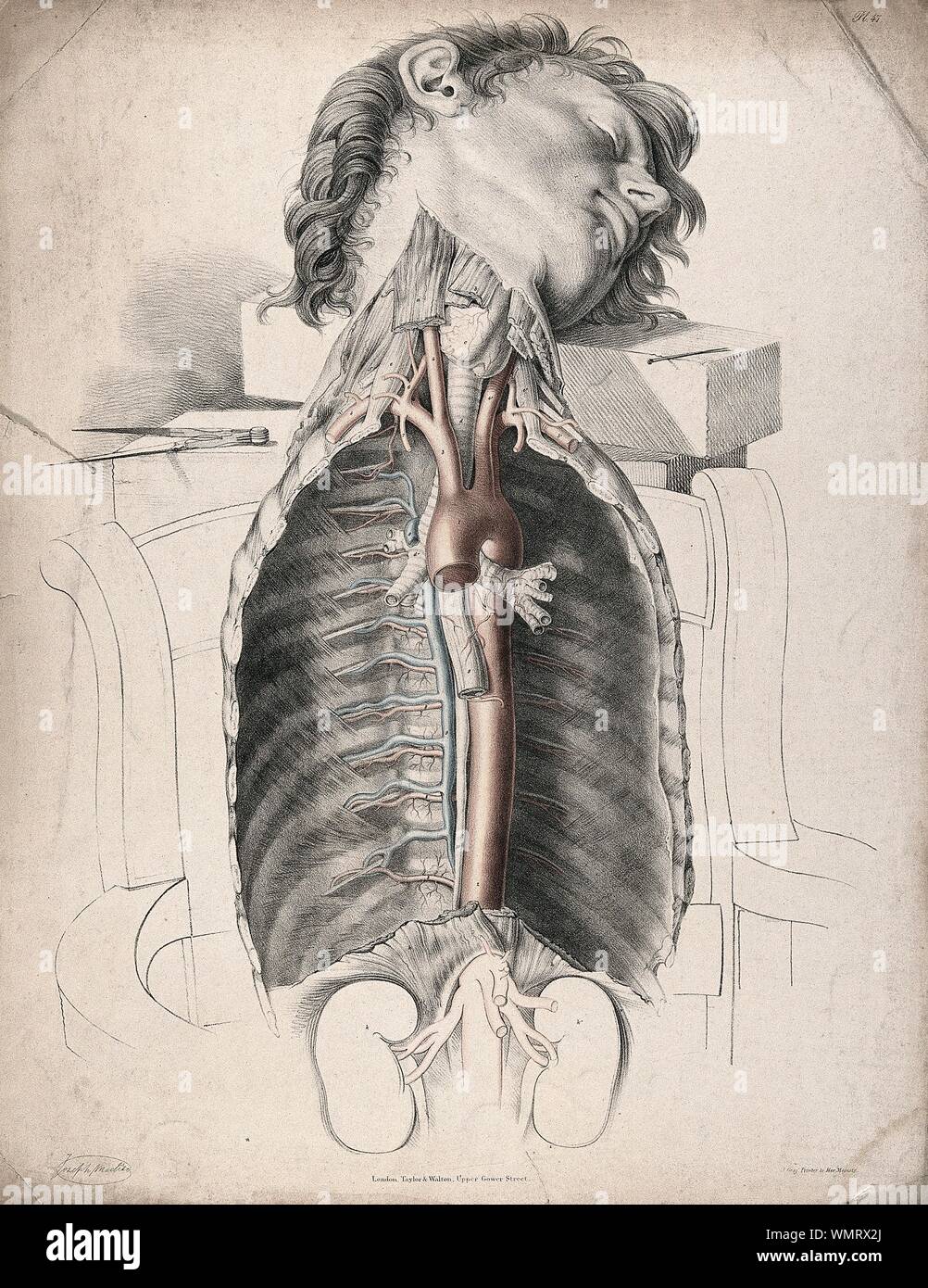 Thorax Dissection High Resolution Stock Photography and Images - Alamy