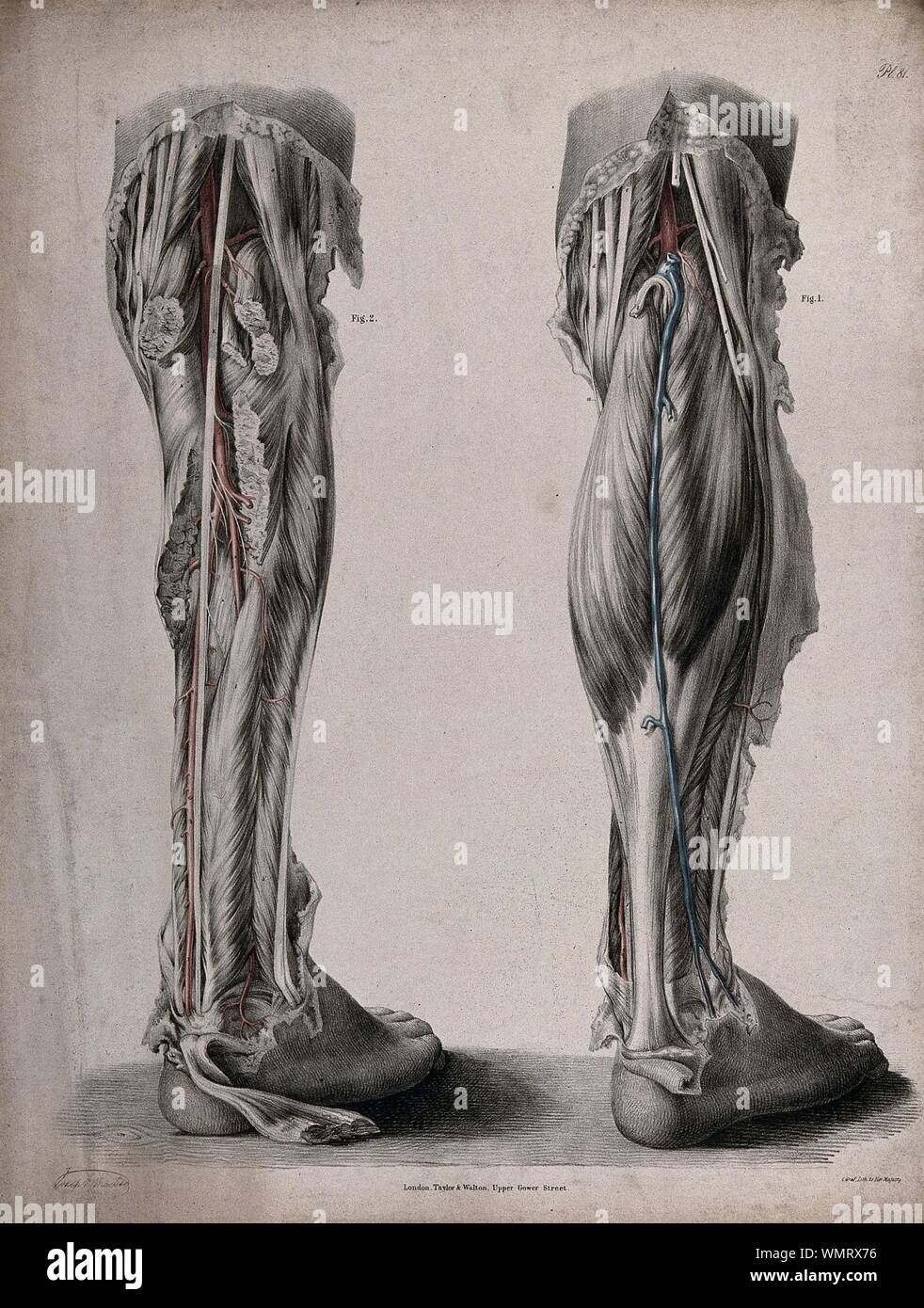 Lung leg hi-res stock photography and images - Alamy