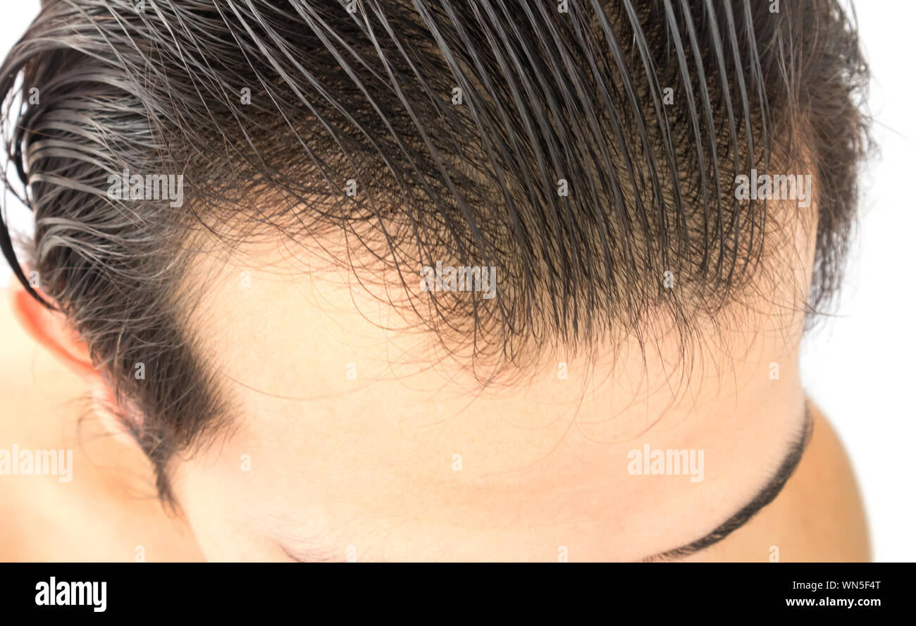 Human Head High Resolution Stock Photography and Images - Alamy