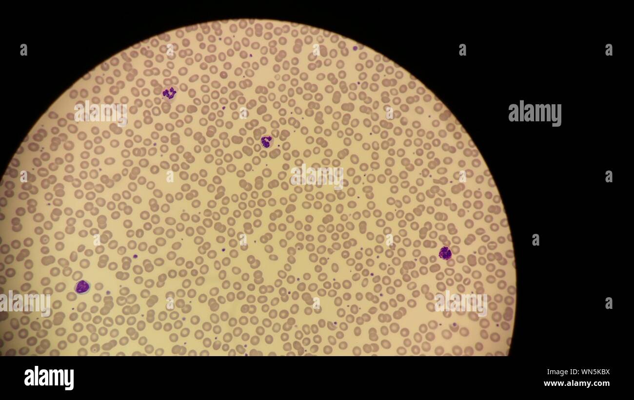 Microscopic Scientific Experiment Stock Photo - Alamy