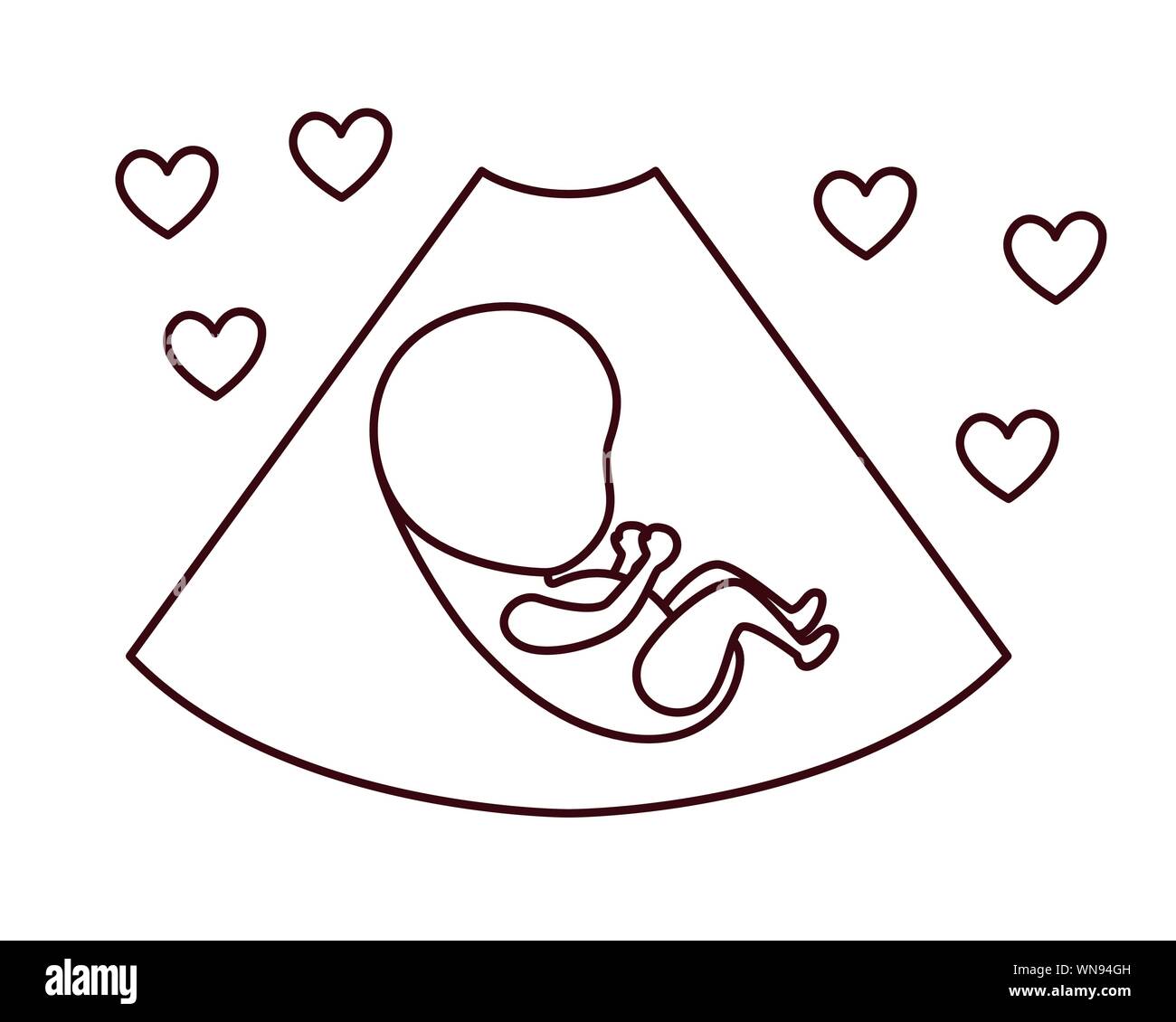 baby fetus pregnancy with hearts love Stock Vector Image & Art - Alamy